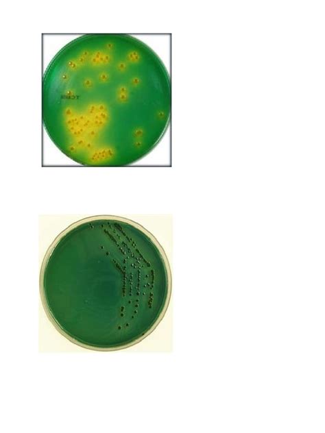 Bile Salt String Test Identification Of Vibrio Cholerae Pdf Chemistry Wellness