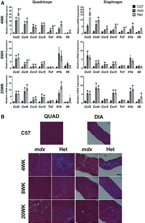 Temporal Gene Expression And Histology Comparing Dystrophic Mouse