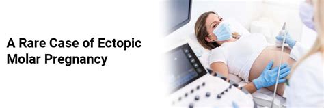 A Rare Case Of Ectopic Molar Pregnancy