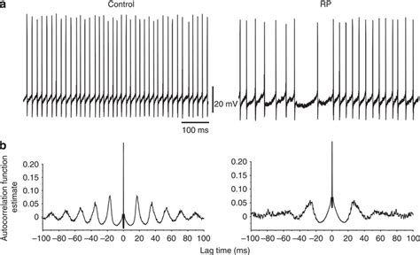 Spike Periodicity During Rp A Spontaneous Spike Firing Trains
