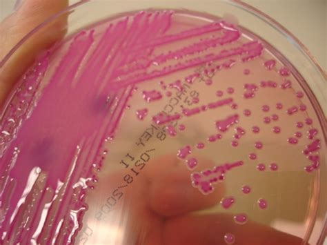 Final Micro Lab Practical Flashcards Quizlet
