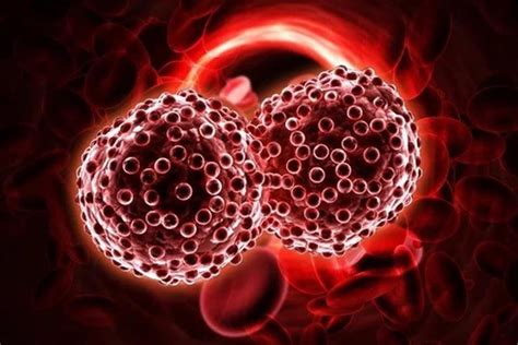 في شهر التوعية بسرطان الدم علامات تحذيرية تكشف انتشاره بجسمك