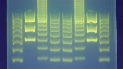 Dna Fingerprinting Definition Examples And Facts Britannica