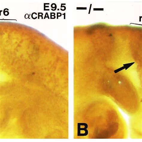 Visualization Of Cranial Neural Crest Cells By Immunostaining With An