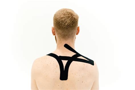 Эстетическое тейпирование кинезотейпирование