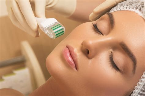 Microneedling For Hyperpigmentation Efficacy Side Effects And More