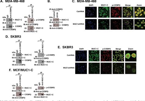 Figure 3 From Muc1 C Oncoprotein Activates Erk→c Ebpβ Signaling And Induction Of Aldehyde