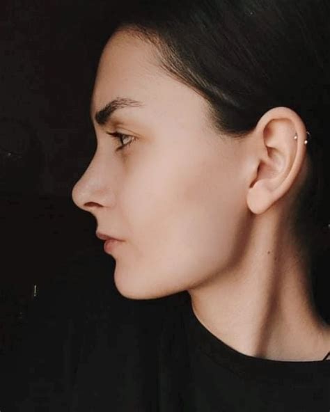 ქეთევან ჯაფარიძე ცხვირის პლასტიკა Home