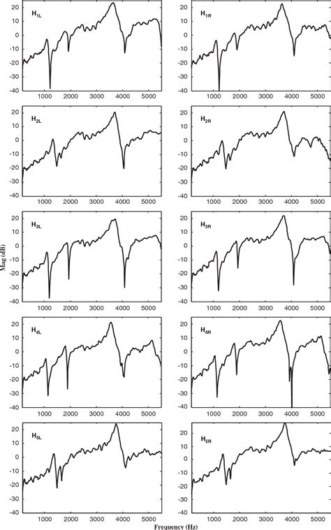 Figure 1 From Development And Implementation Of Cross Talk Cancellation System In Spatial Audio