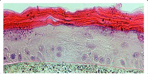 Hematoxylin And Eosin Staining Of Three Dimensional Epidermal Tissue