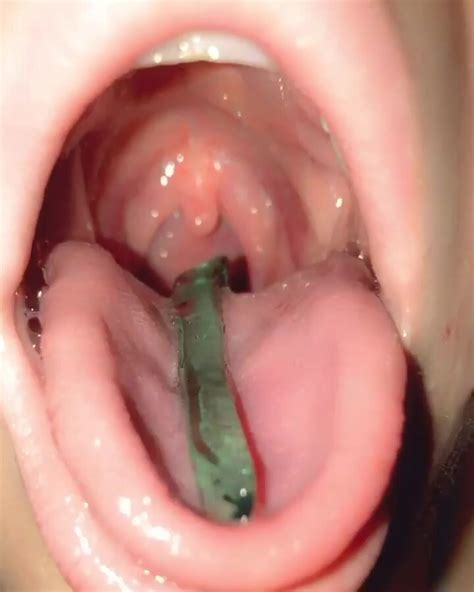 Instagram Gummy Swallow