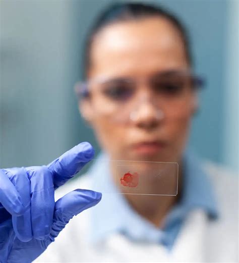 In Vitro Diagnostics Mecomed