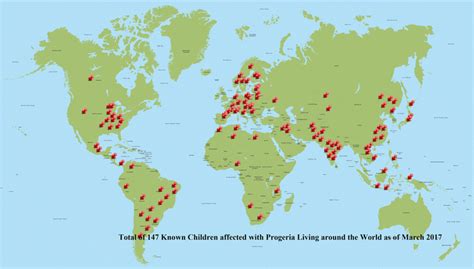 Progeria Statistics Worldwide Common Front Against Progeria The Aging