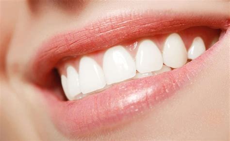 How To Make Teeth Alignment Fashionable Suntrics