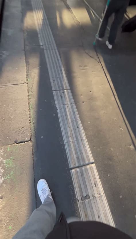 Injured Woman Crutching Candid