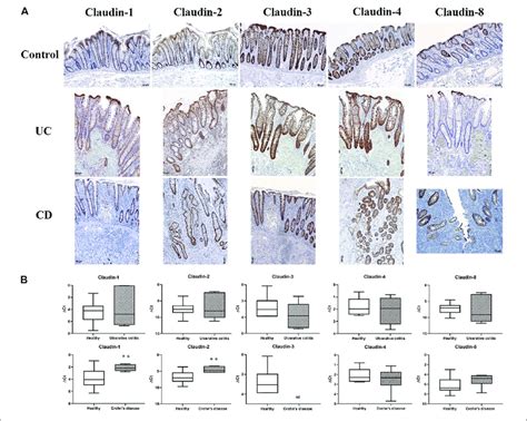 Claudin 1 Claudin 2 Claudin 3 Claudin 4 And Claudin 8 Expression