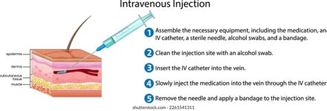 Intravenous Injection Explanation Illustration Stock Vector Royalty Free 2261541311 Shutterstock