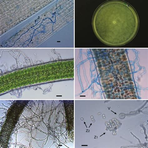 Pythium Sp Isolate NIBIO 231095 A Hyphae Infecting A Filament Of