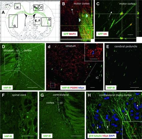 Axon Outgrowth From Motor Cortex Transplants A Schematic Download