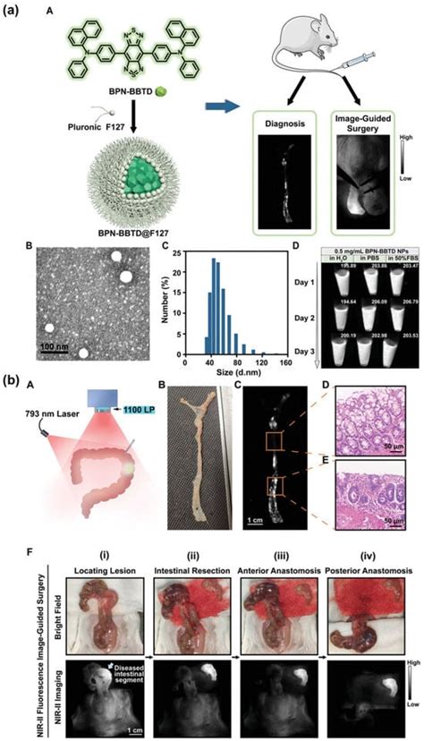 Nir Ii Fluorescent Probes For Fluorescence Imaging Guided Tumor Surgery