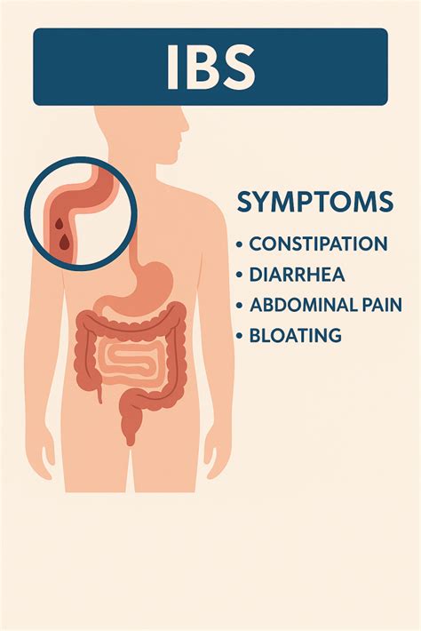 Understanding Ibs Symptoms Causes And Treatment Options Colon