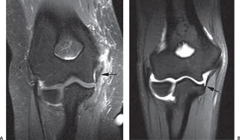 The Elbow Radiology Key