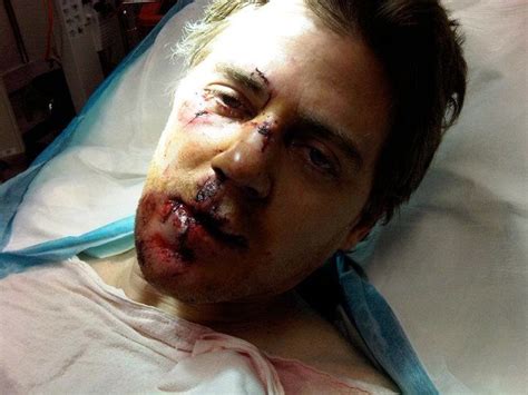 Matt Oswalt Voted 8 Ep Of 2014 The Mental Illness Happy Hour