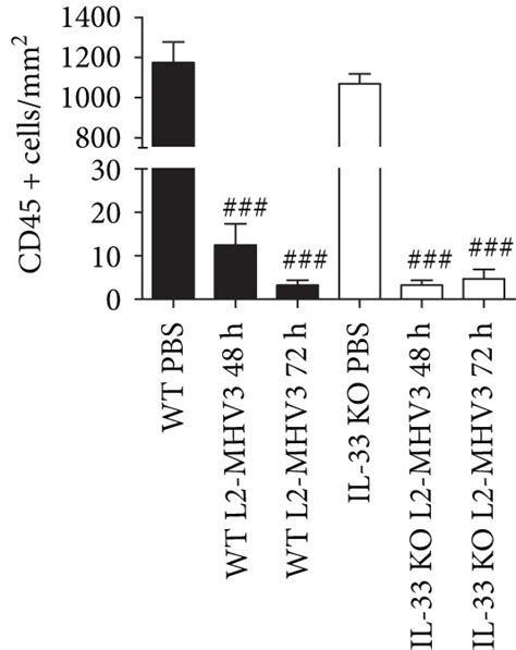 Flow Cytometry Analysis And Immunohistochemistry Of Liver Infiltrated