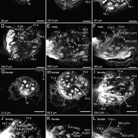 Glomeruli And Their Associated Sensory Tracts In The Al Of A Male