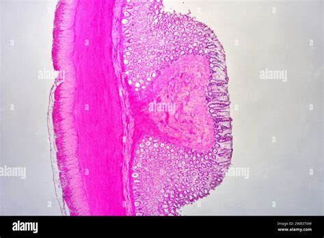 Human Vermiform Appendix Cross Section Showing Left To Right Serous Layer Muscular