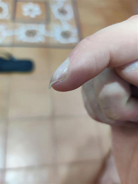 My Strings Always Eat My Nailsi Use Hardner And I File Them Yet I Always Get Those Cracks On