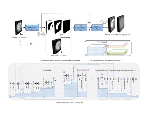 H Denseunet Hybrid Densely Connected Unet For Liver And Liver Tumor Segmentation From Ct