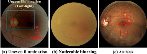 Figure 3 From A Reference Free Self Supervised Domain Adaptation Framework For Low Quality