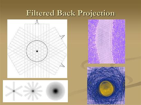 Ppt Mri Fbp And Phase Encoding Powerpoint Presentation Free