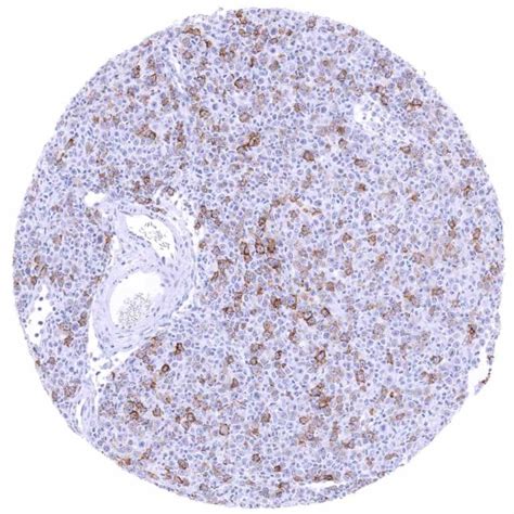 Cancer Tissue Gallery Igd Ms Validated Antibodies