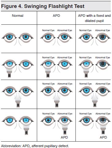Visual Fields And Ocular Motility