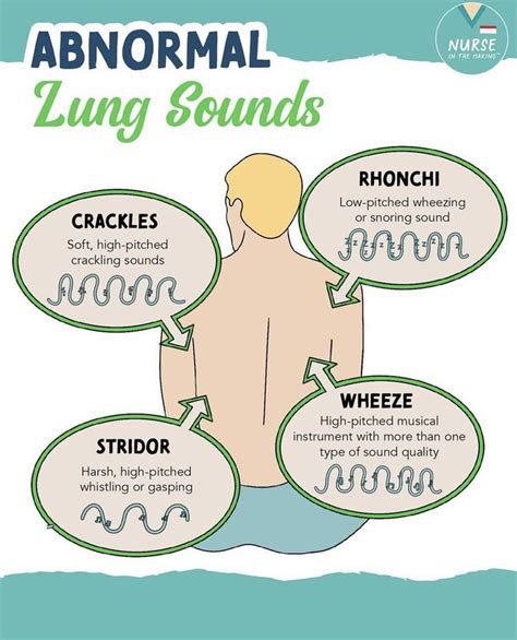 Neonatal Lung Sounds Diagram