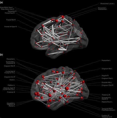 The connectivity matrix ΔCM of a streamline counts and b Download Scientific Diagram