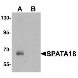 Mitochondria Eating Protein SPATA Antibody