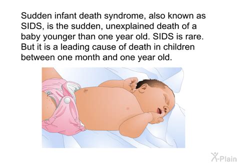 Sudden Infant Death Syndrome Sids