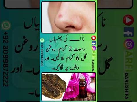 Naak Ki Funsi Ka Gharelu Ilaj YouTube