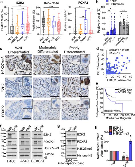 Decoupling Of Ezh2 From Prc2 Activity May Explain Co Expression Of Ezh2