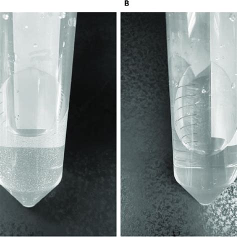 Preparation Of Sucrose Buffer A Sucrose Buffer With Bubbles Caused By