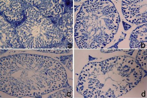 Sections Of Testis Stained With Bromophenol Blue A Control Mice B