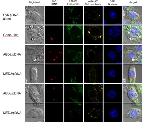 Confocal Imaging Of Polyplex Uptake In Raw2647 Macrophages Images