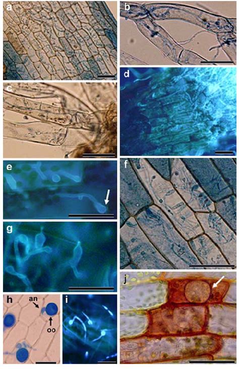 Invasion Of P Patens Tissues By Pythium Irregulare And Pythium Download Scientific Diagram
