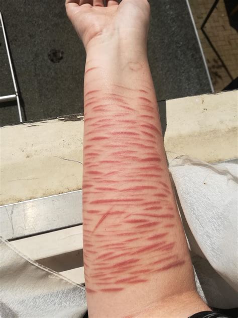 Scars By Wils
