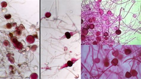 Cryptococcus Neoformans Structure Infection Habitat Biology Notes Online