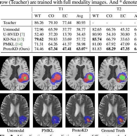 Figure 1 From Prototype Knowledge Distillation For Medical Segmentation With Missing Modality