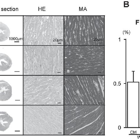 Histological Evaluation Of Ventricles With Or Without Dox Injection A Download Scientific
